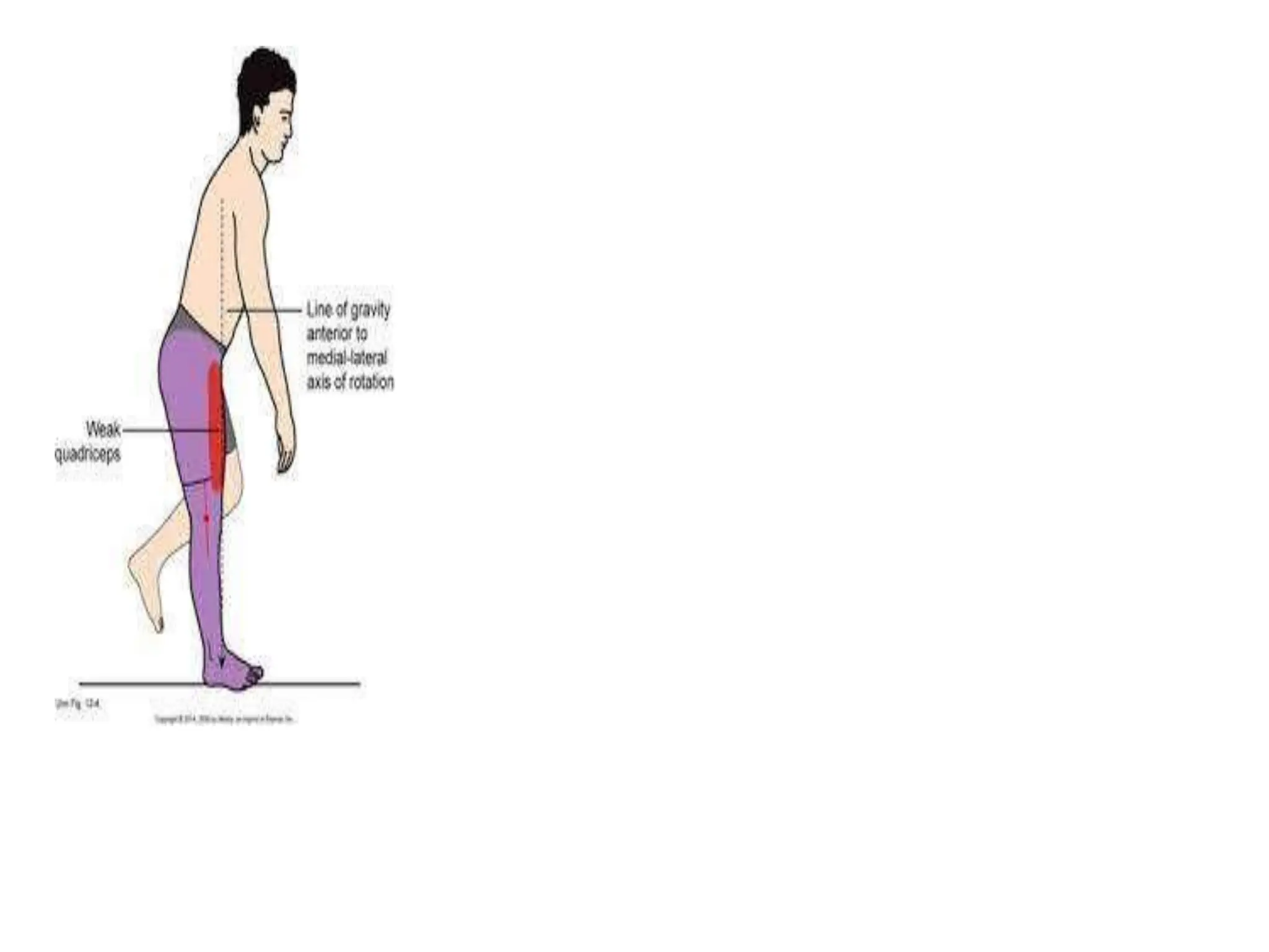 Biomechanics Gait Gait cycle types .pptx