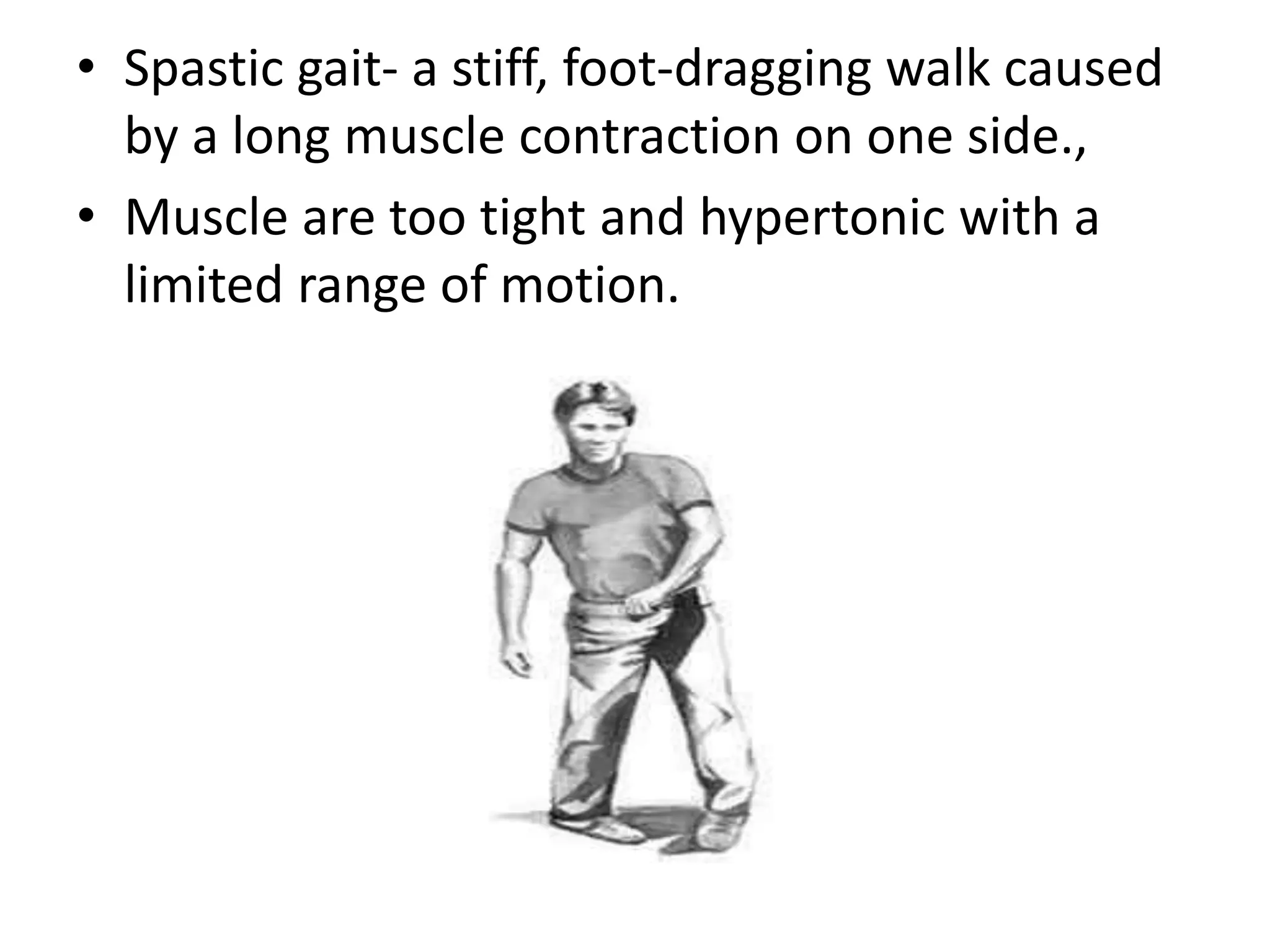 Biomechanics Gait Gait cycle types .pptx