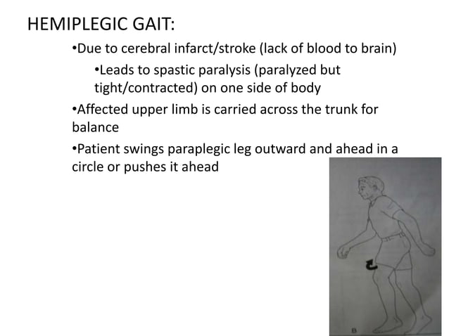 Biomechanics Gait Gait cycle types .pptx