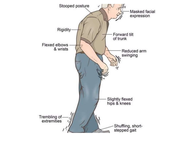 Biomechanics Gait Gait cycle types .pptx