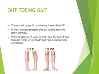Gait | PPT