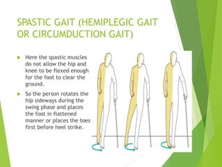 Gait | PPT