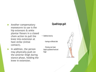 Quadriceps Gait