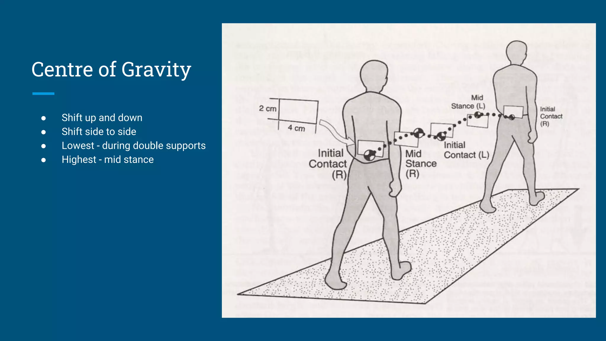 Gait & Approach to a limping child | PDF
