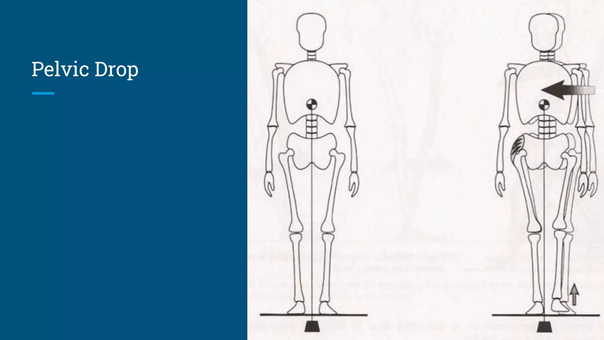 Gait & Approach to a limping child | PDF