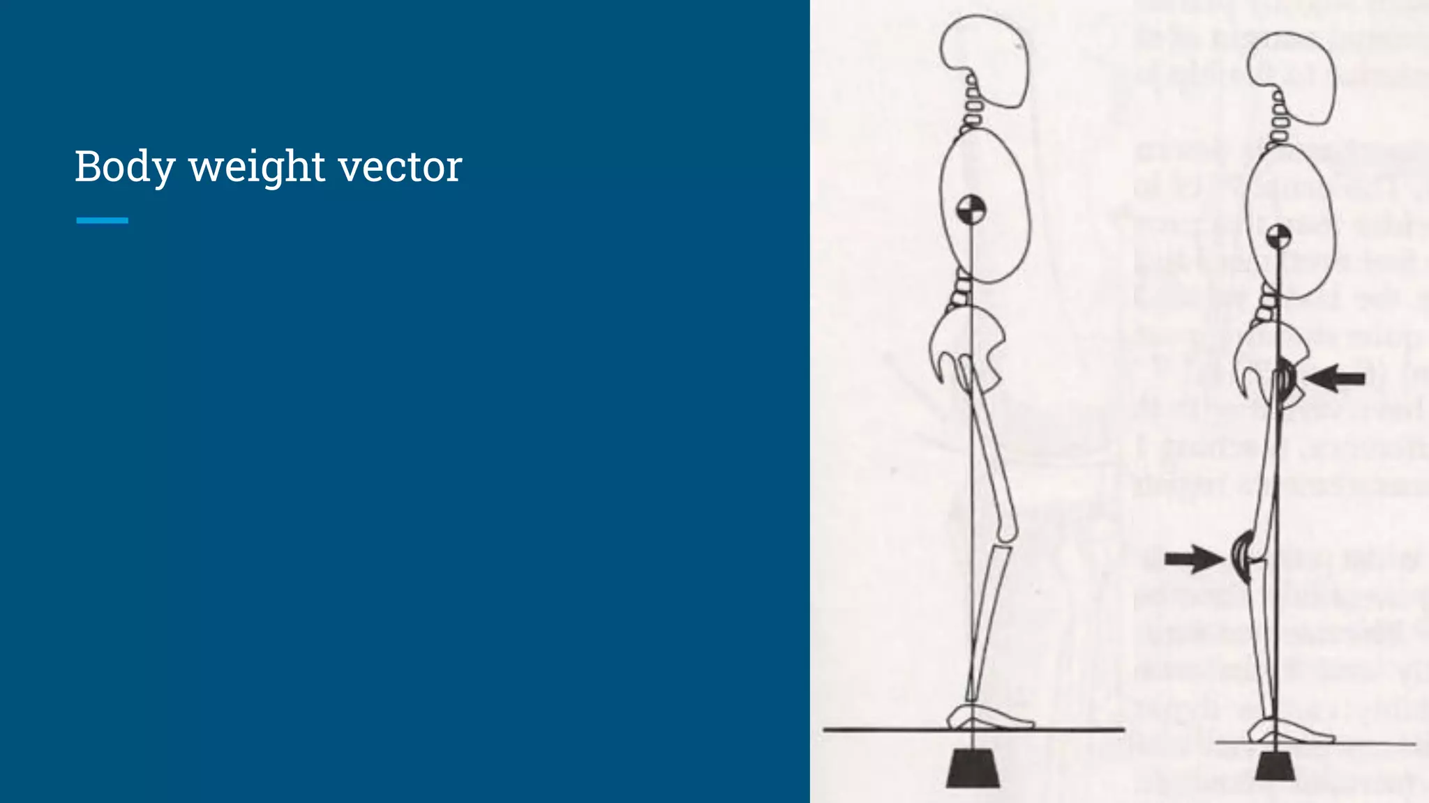 Gait & Approach to a limping child | PPT