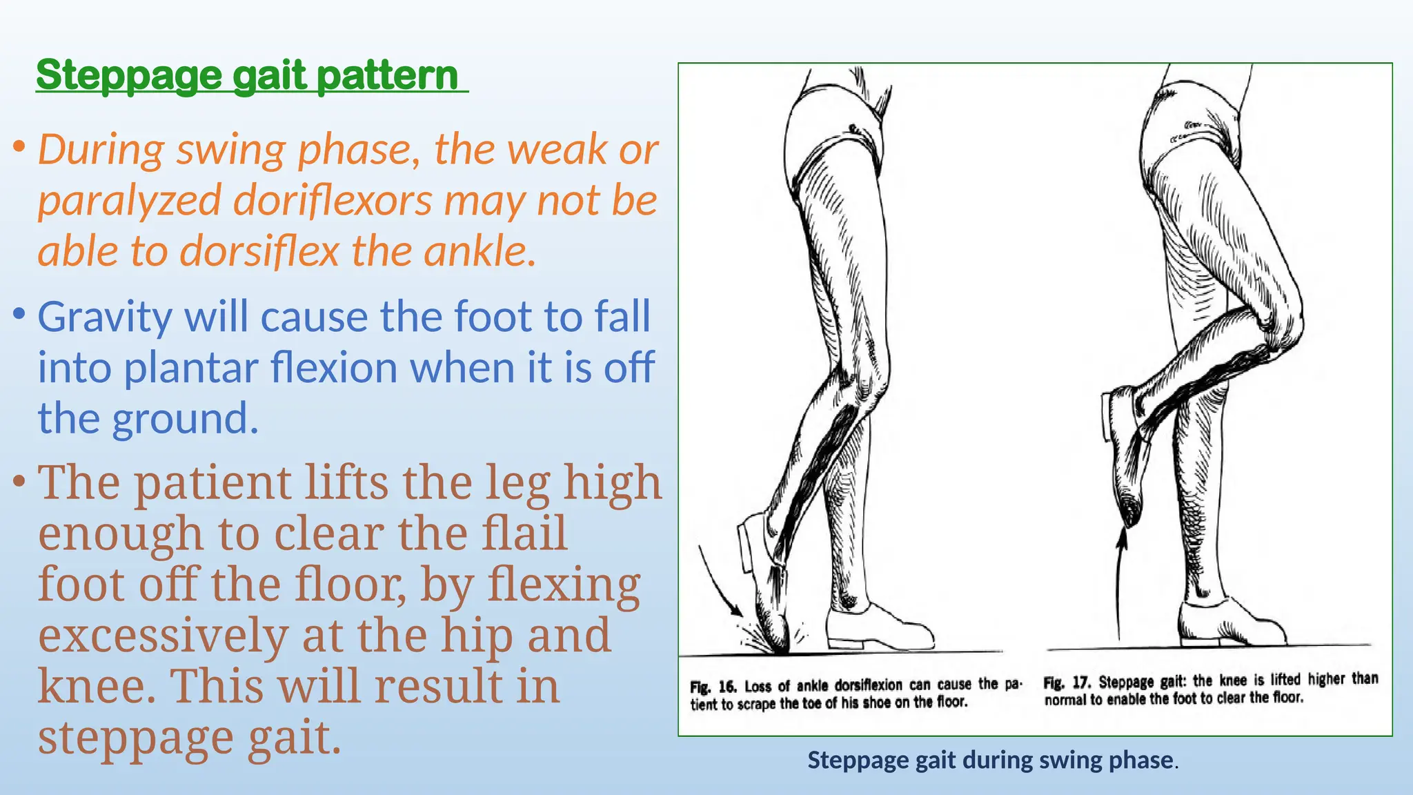 Gait ,gait cycle,phases of gait, different gait patterns. | PPTX