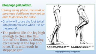 Gait ,gait cycle,phases of gait, different gait patterns. | PPTX