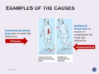 Human Gait - Basics, Pathology & Analysis.pptx
