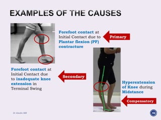 Human Gait - Basics, Pathology & Analysis.pptx