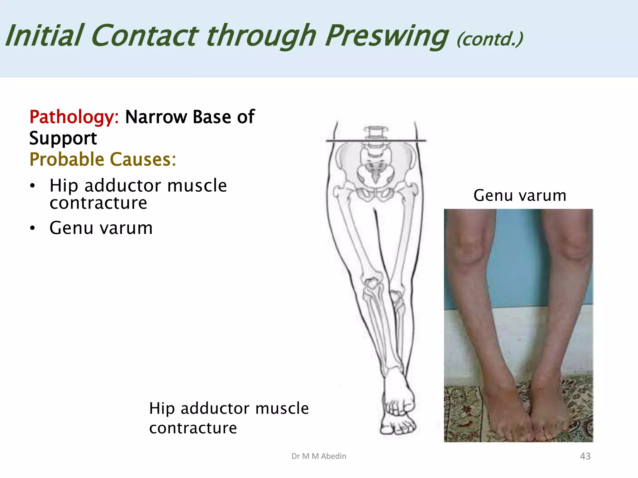 Gait Analysis - Components and Abnormalities.pptx