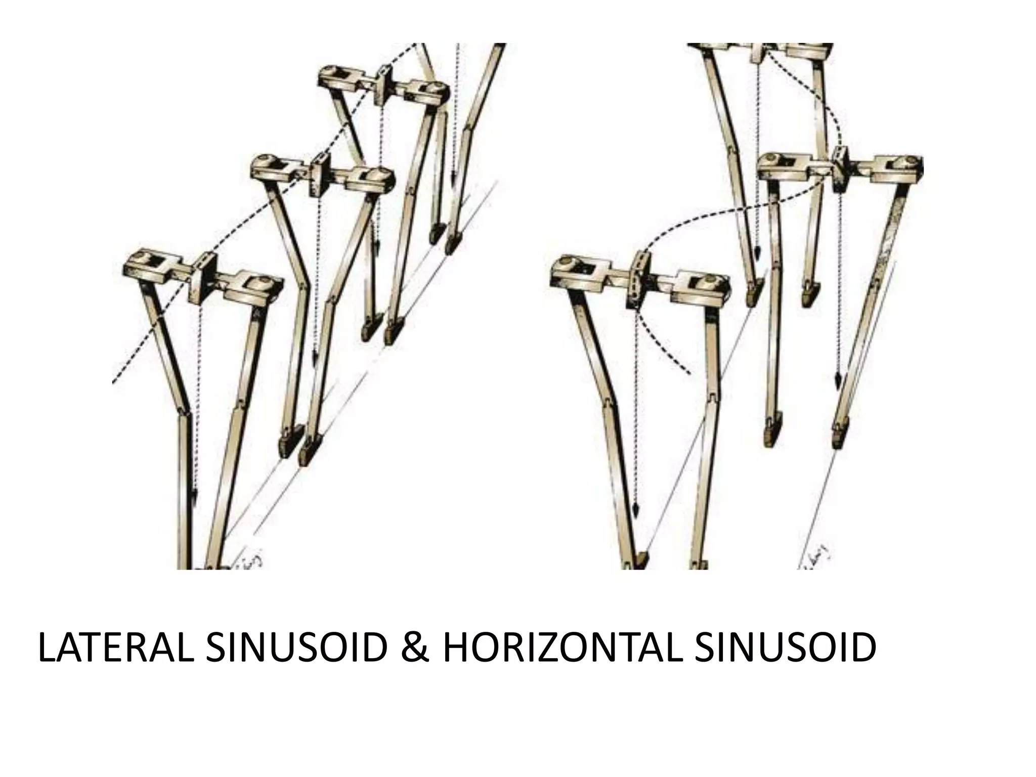 Gait parameters , determinants and assessment (2) | PPTX
