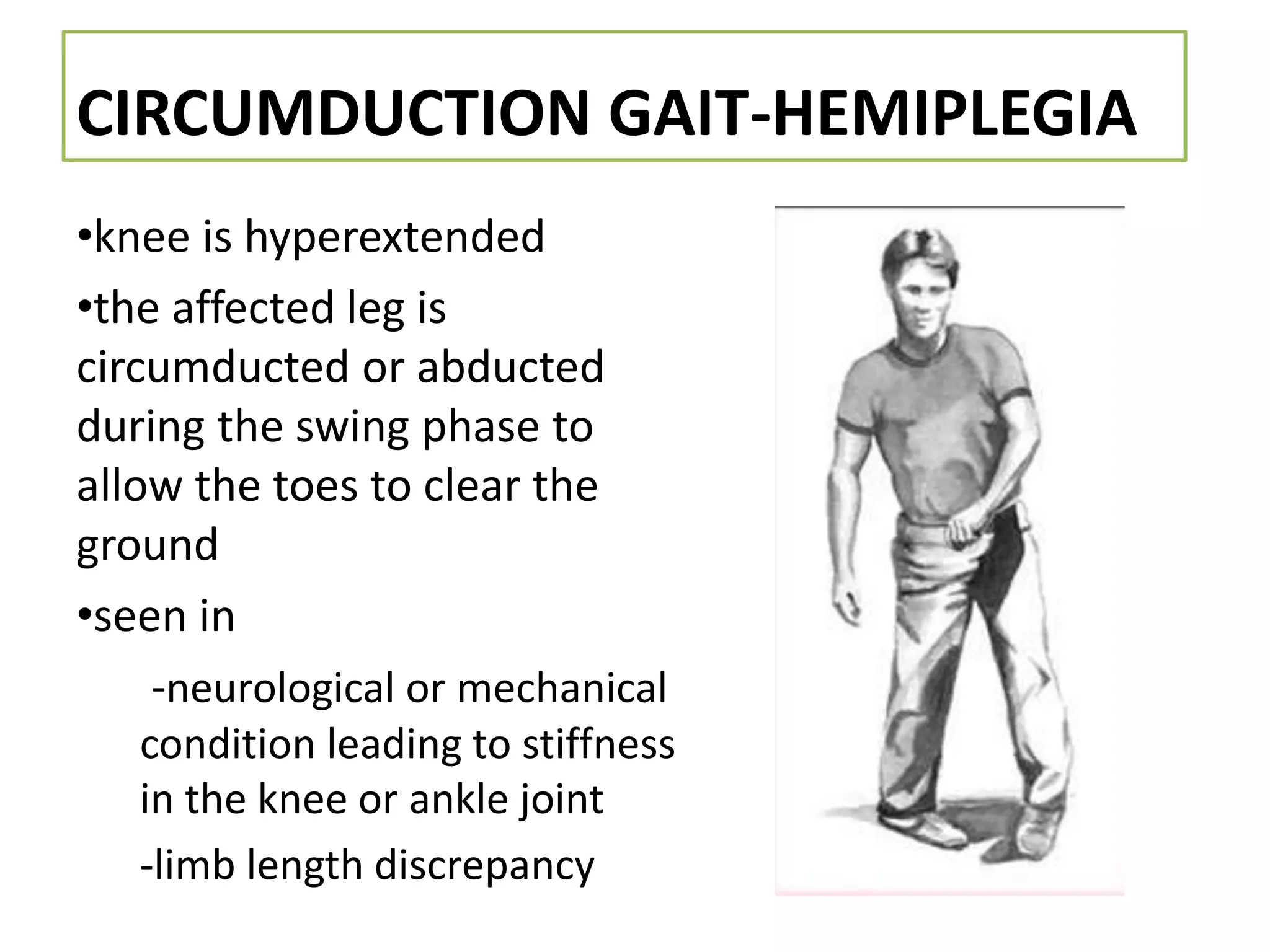 Gait parameters , determinants and assessment (2) | PPTX