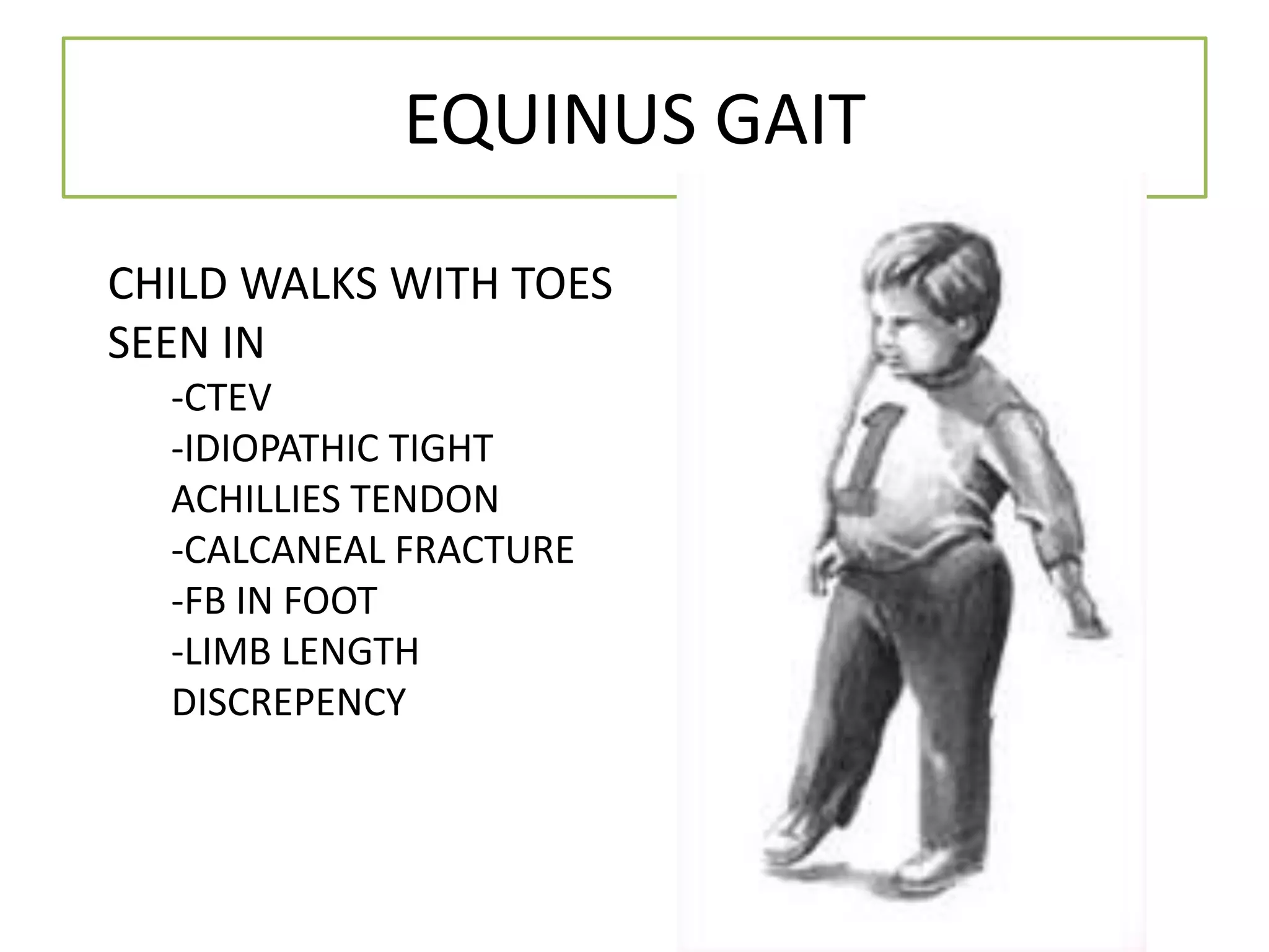 Gait parameters , determinants and assessment (2) | PPTX