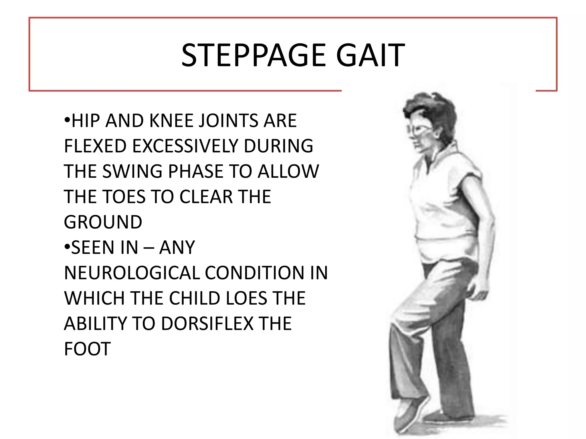 Gait parameters , determinants and assessment (2) | PPTX