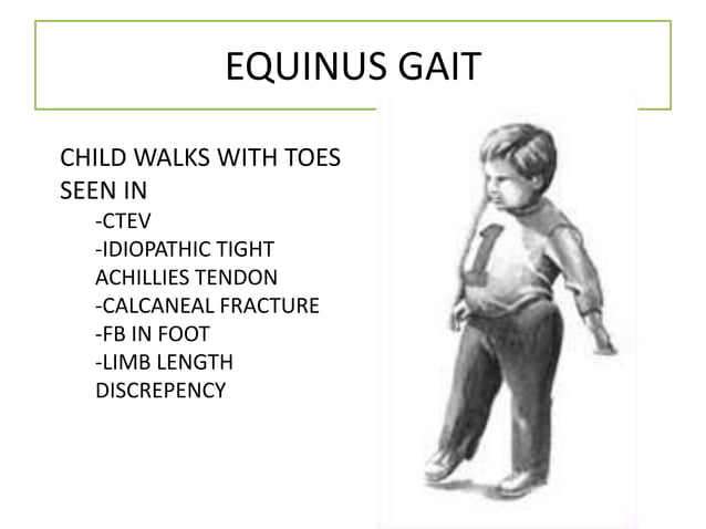 Gait parameters , determinants and assessment (2) | PPTX | Death, Injury, or Military Conflict ...