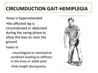 Circumduction Gait