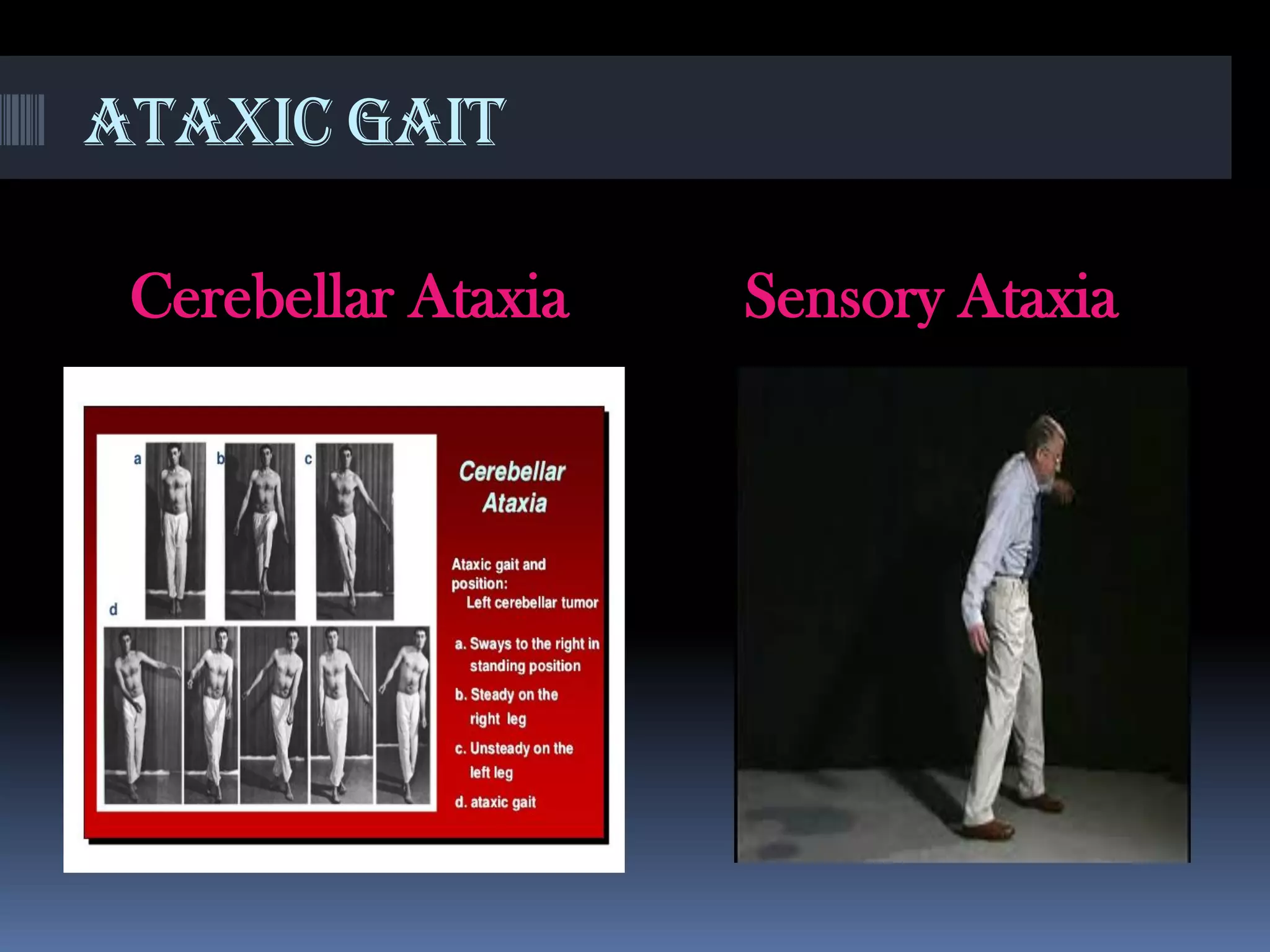 Gait-Abnormal Gait by surya likhita | PPT