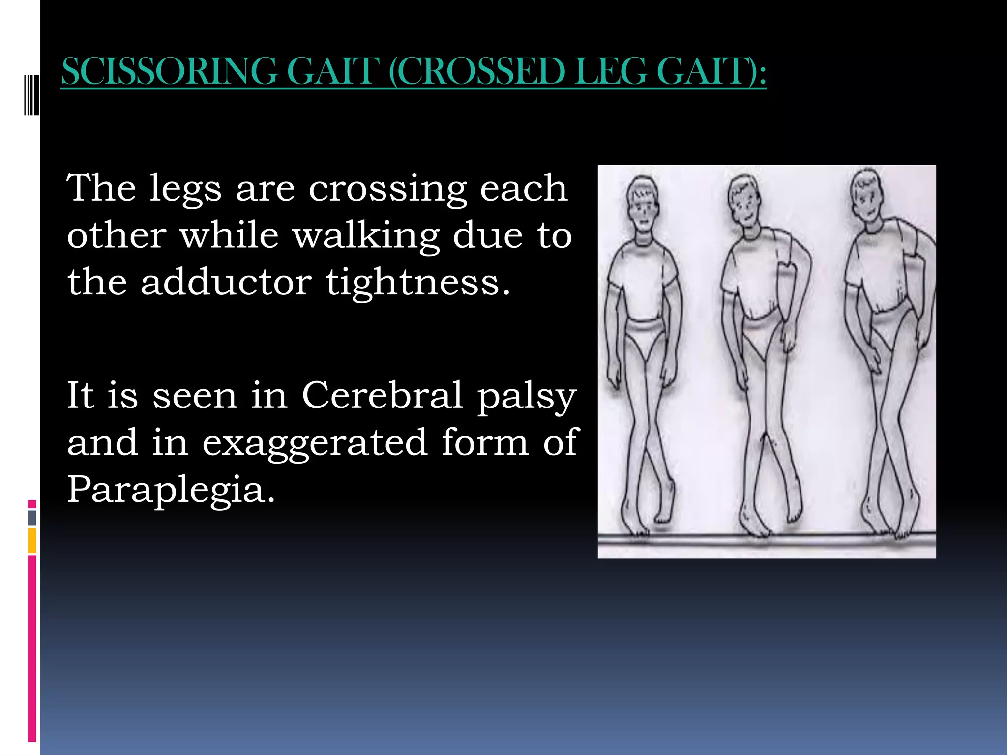 Gait-Abnormal Gait by surya likhita | PPT