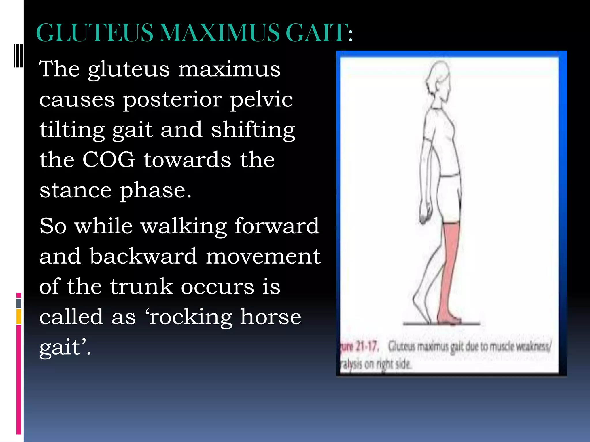 Gait-Abnormal Gait by surya likhita | PPT