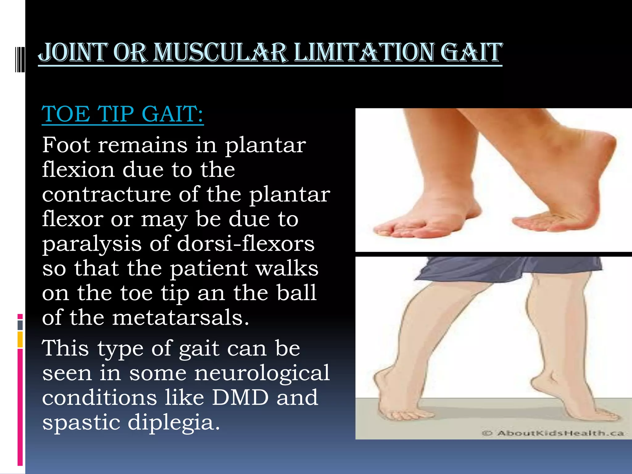 Gait-Abnormal Gait by surya likhita | PPT