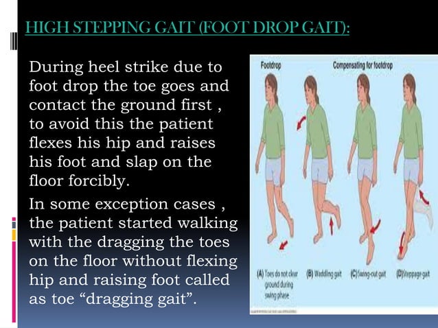 Gait-Abnormal Gait by surya likhita | PPT