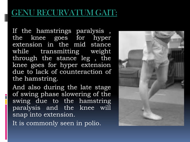 Gait-Abnormal Gait by surya likhita | PPT