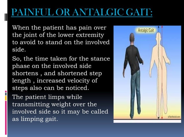 Gait-Abnormal Gait by surya likhita | PPT