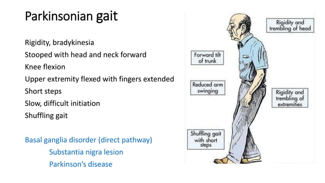 Gait abnormalities | PPTX
