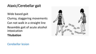Gait abnormalities | PPTX