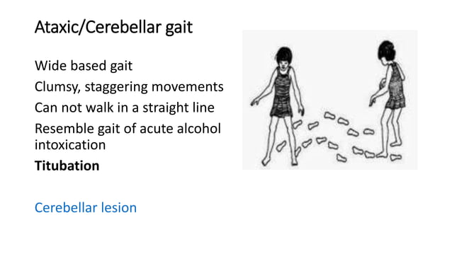Gait abnormalities | PPTX