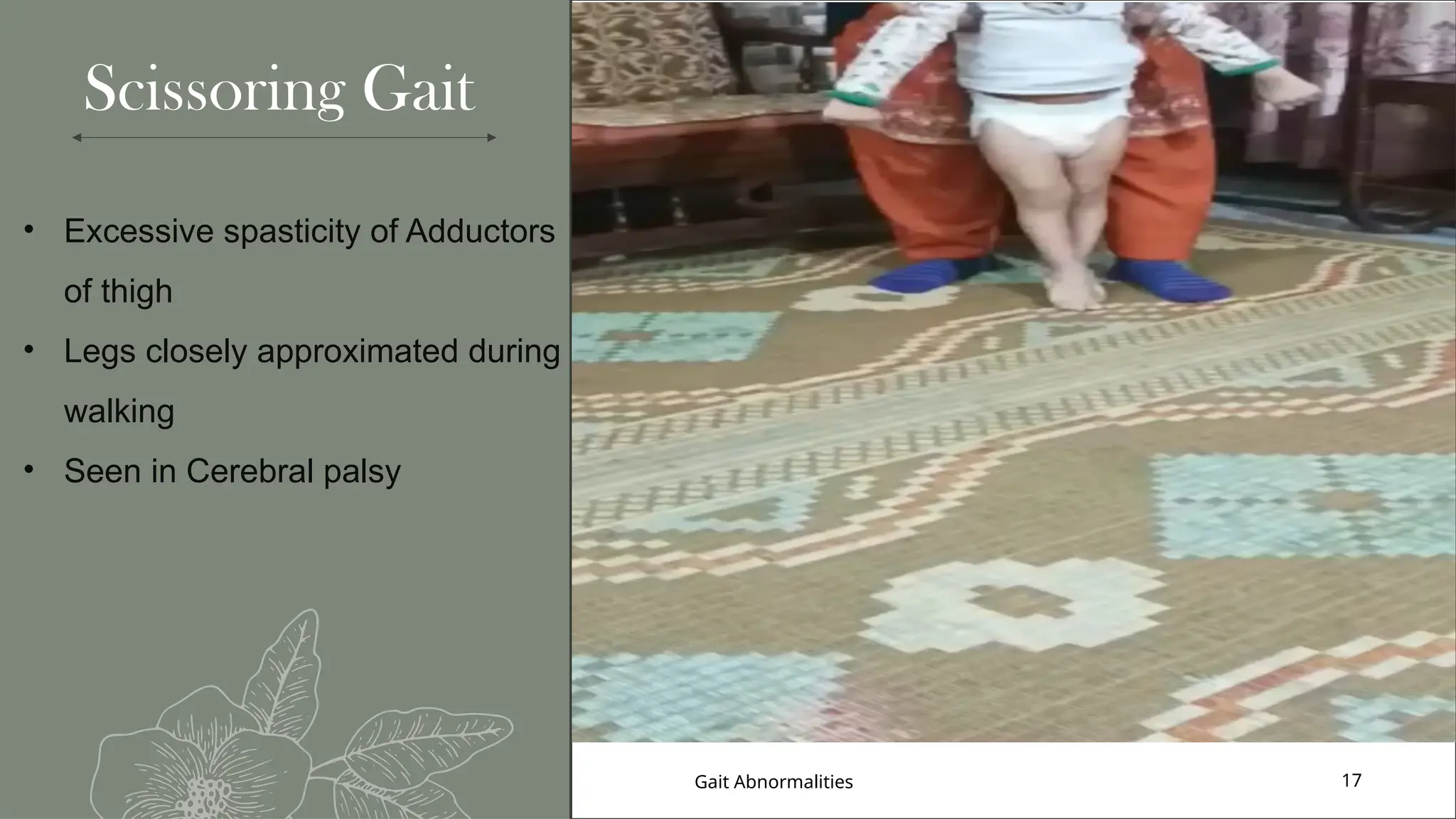 Different types of Gait Abnormalities ppt | PPTX