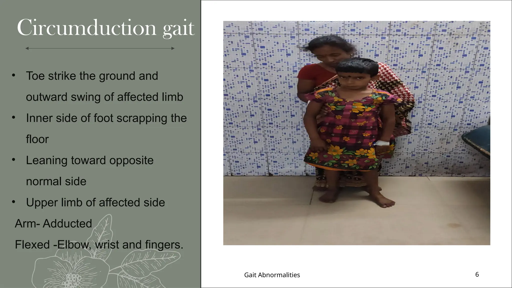 Different types of Gait Abnormalities ppt | PPTX