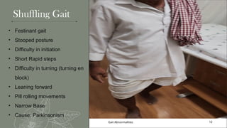 Different types of Gait Abnormalities ppt | PPTX
