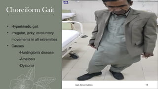 Different types of Gait Abnormalities ppt | PPTX