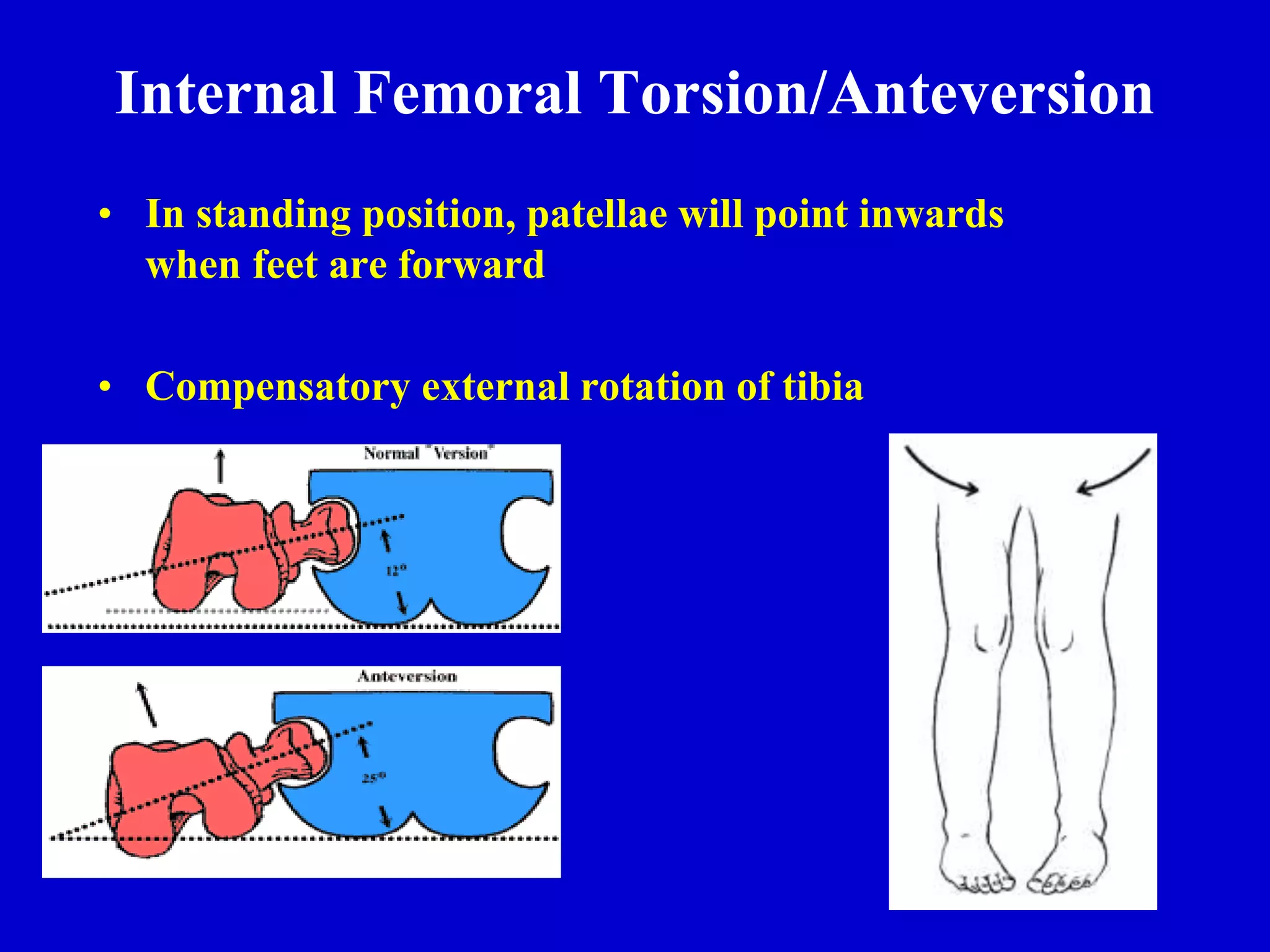 gait abnormalities in children.ppt