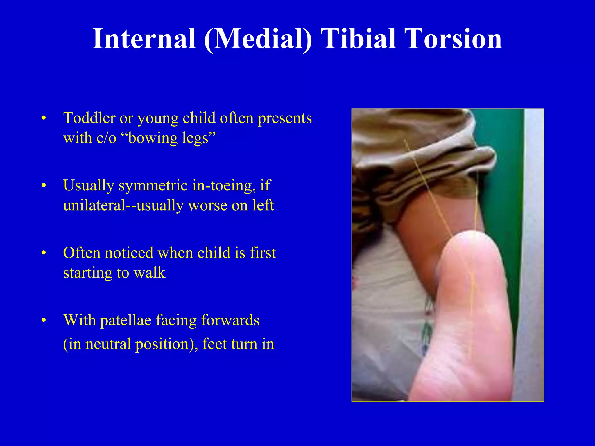 gait abnormalities in children.ppt