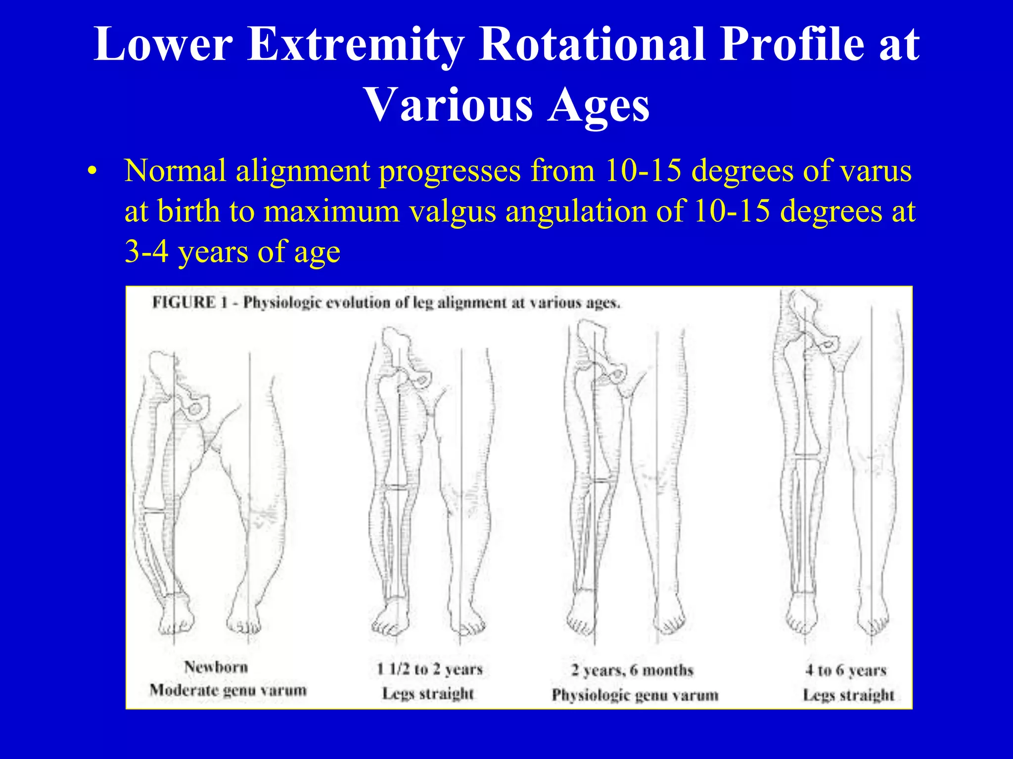 gait abnormalities in children.ppt