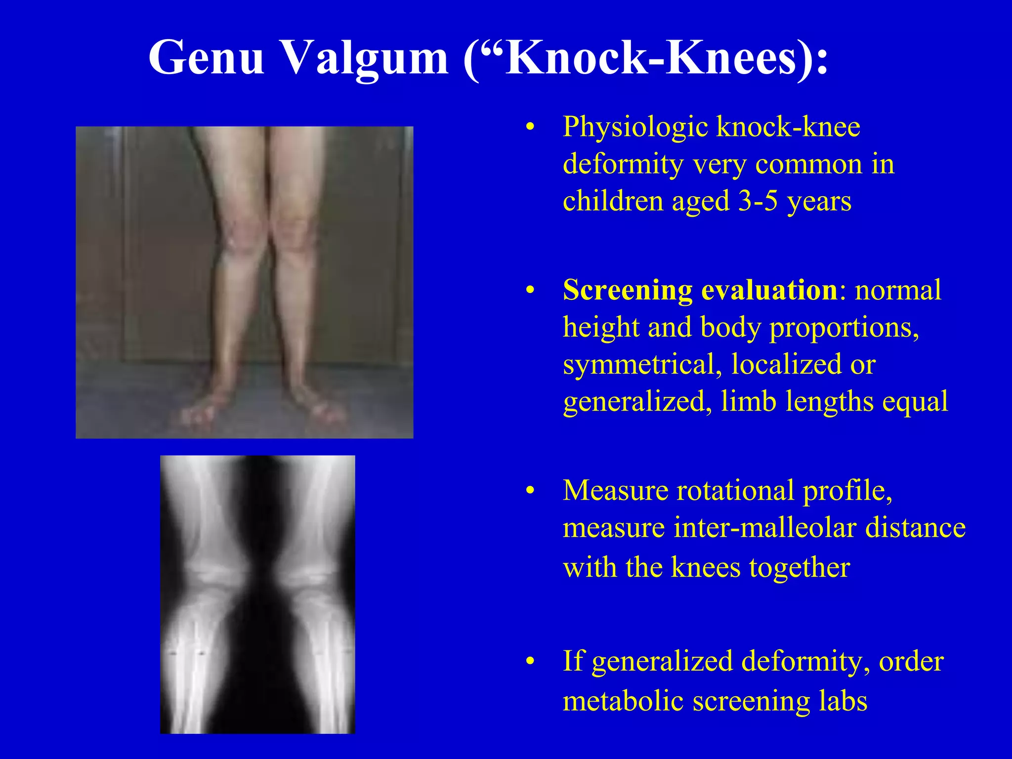 gait abnormalities in children.ppt