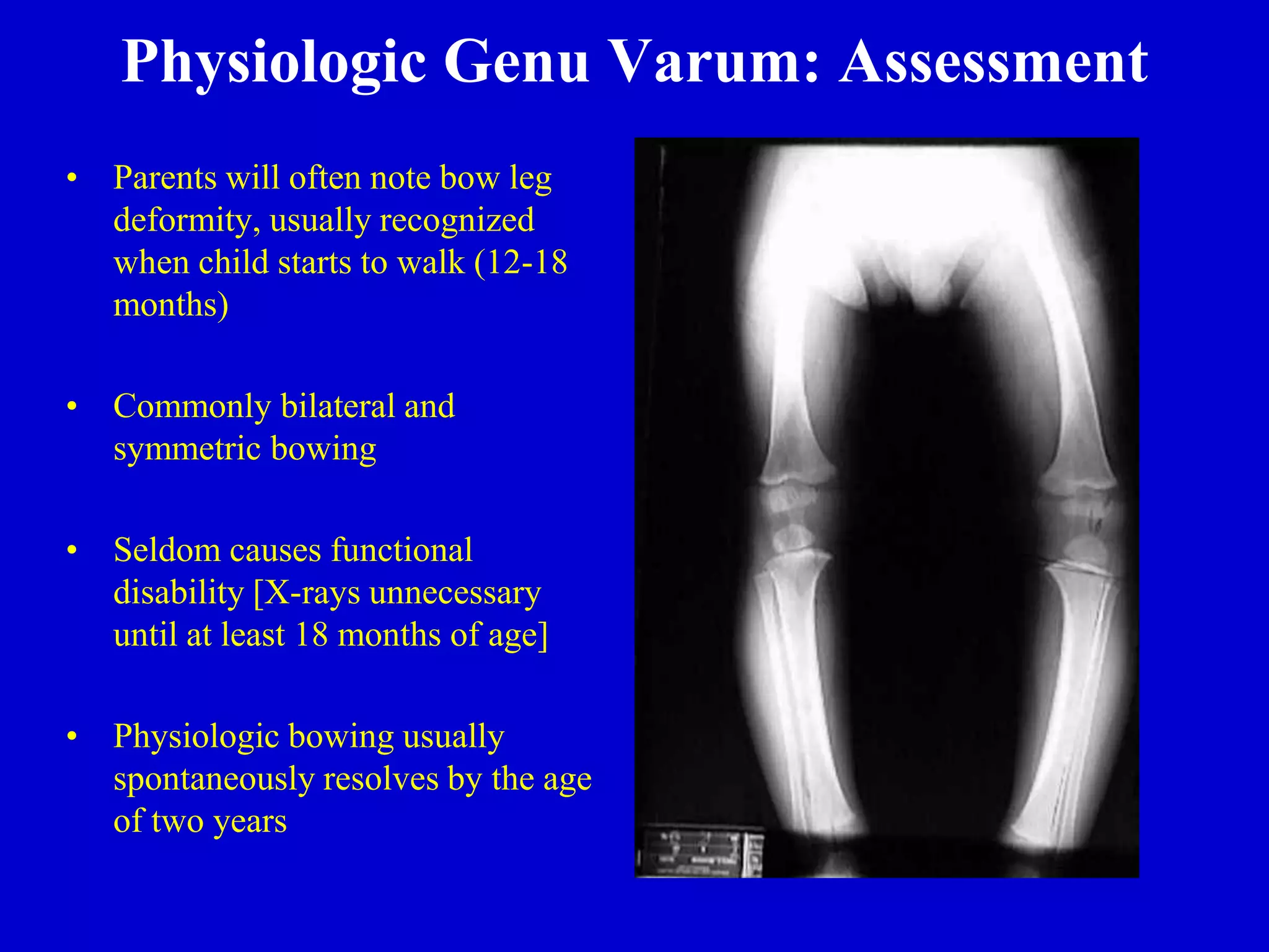 gait abnormalities in children.ppt