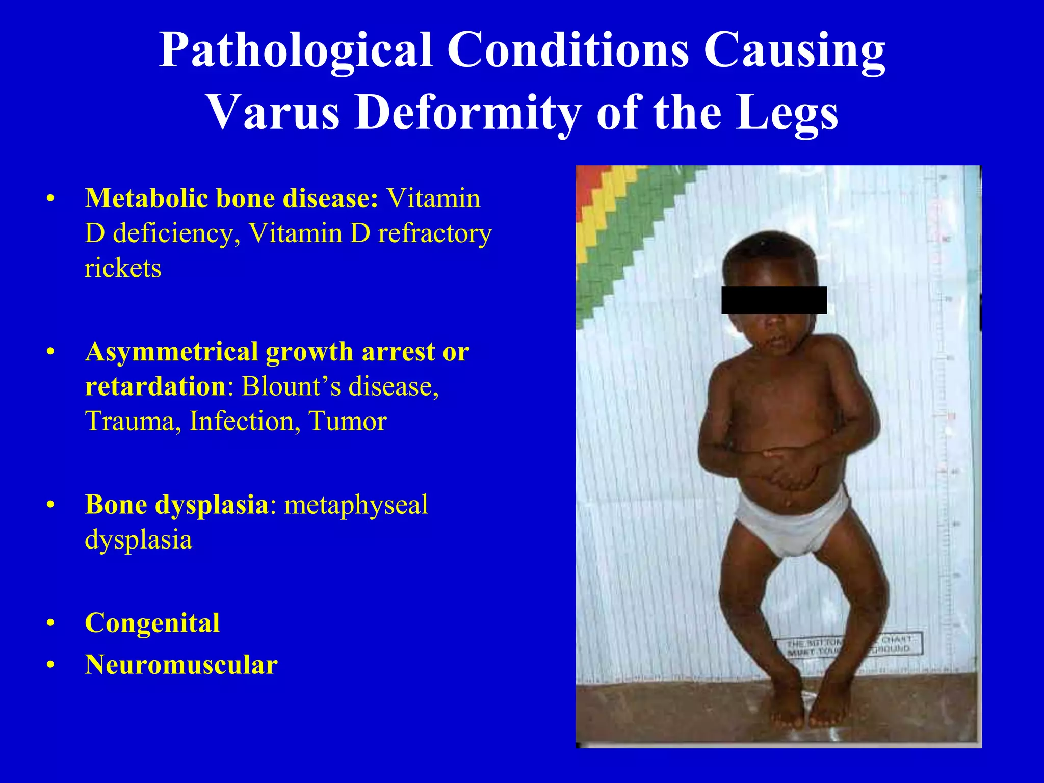gait abnormalities in children.ppt