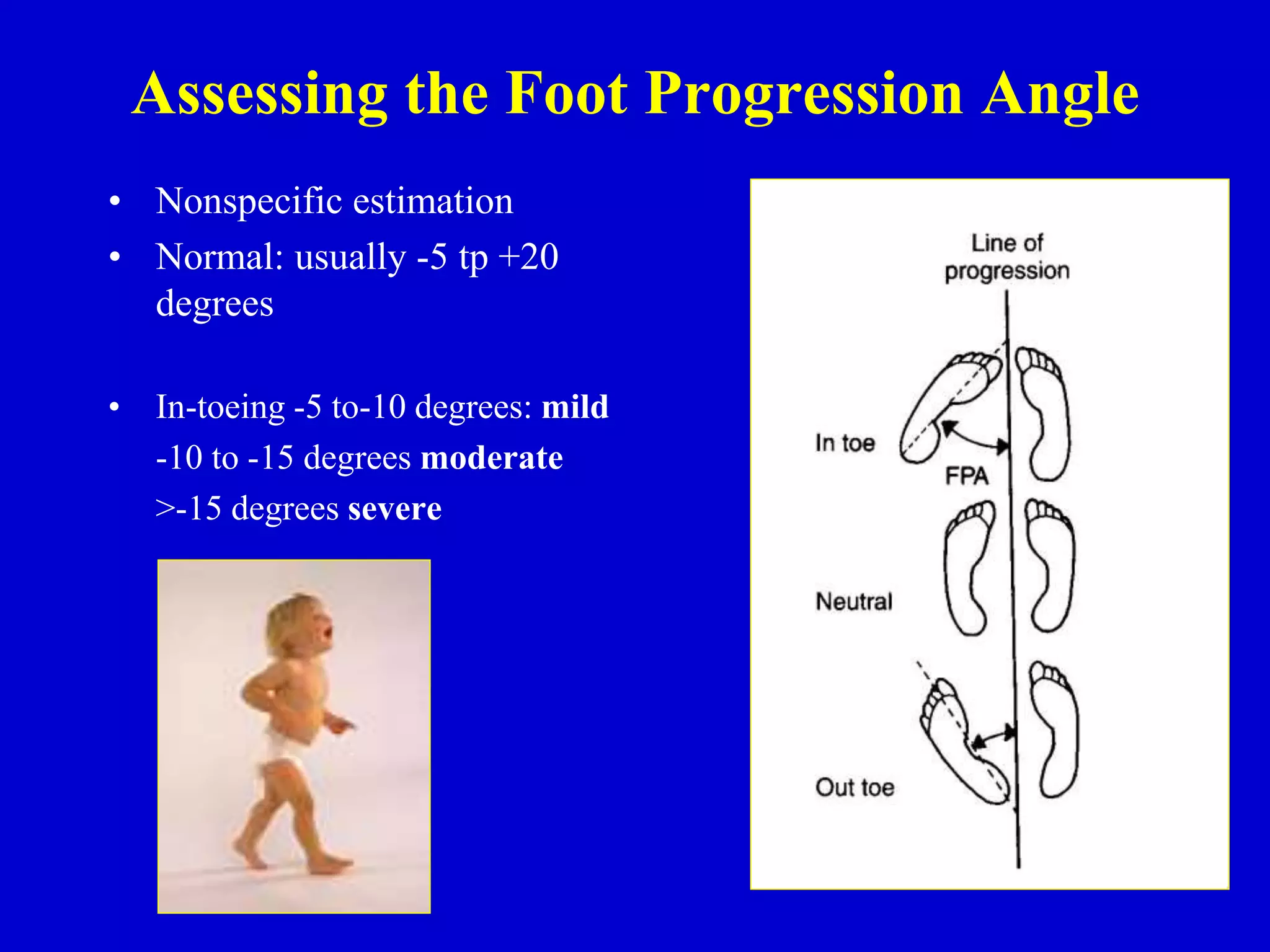 gait abnormalities in children.ppt