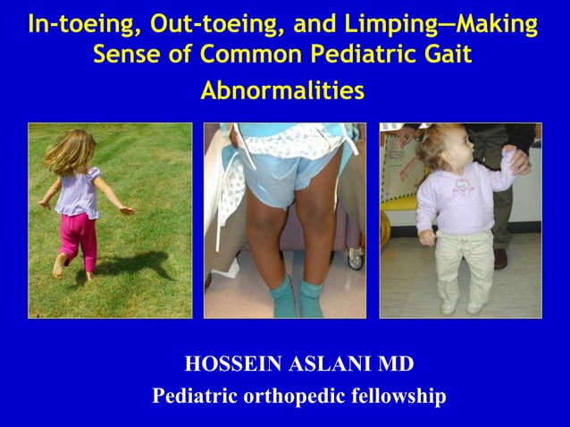 gait abnormalities in children.ppt | Physical Therapy | Wellness