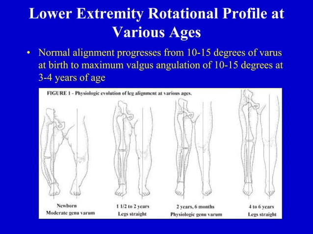 gait abnormalities in children.ppt | Physical Therapy | Wellness
