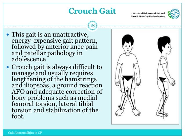Gait abnormalities in children with cp final