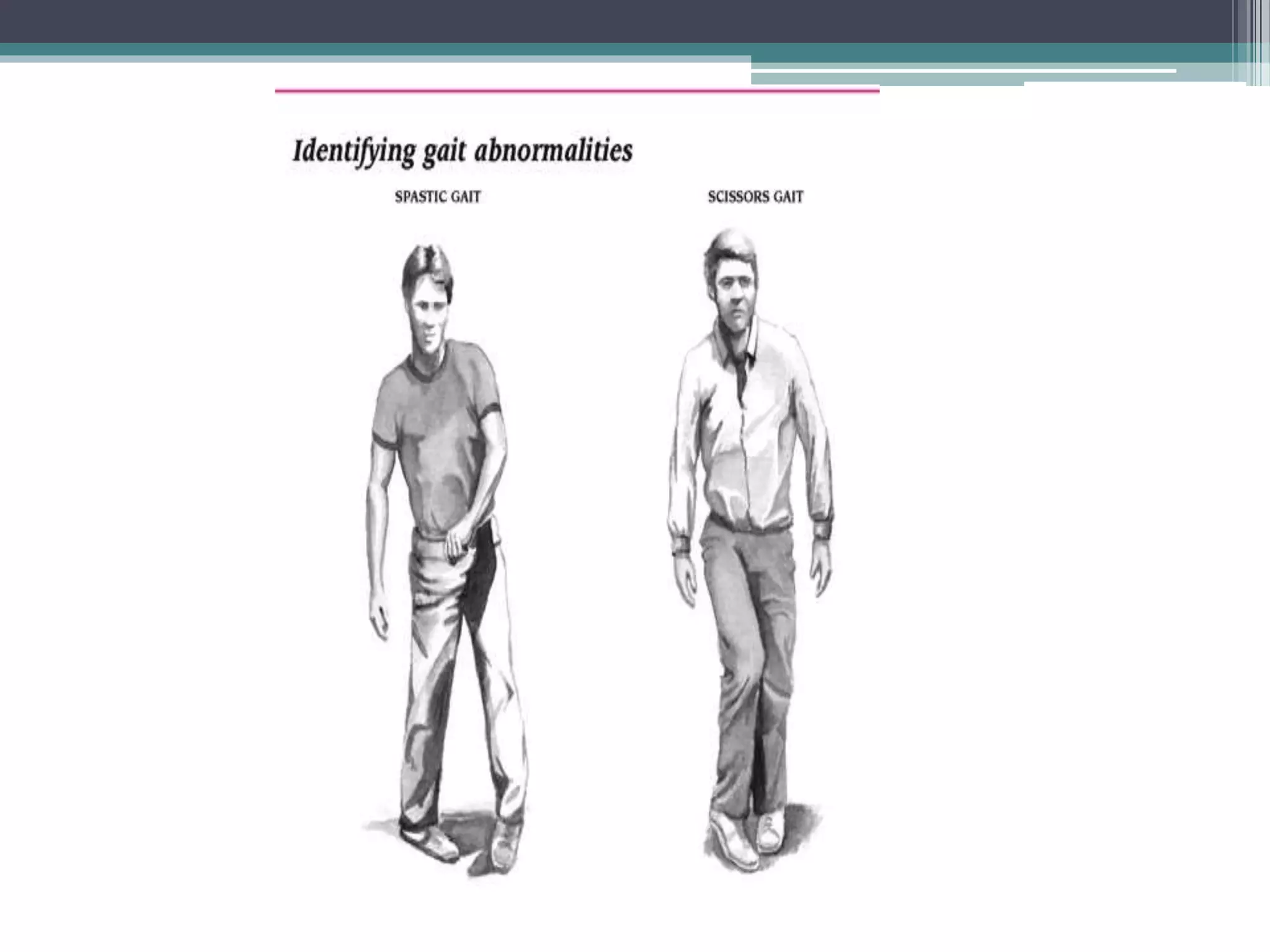 Gait abnormalities presentation | PPTX