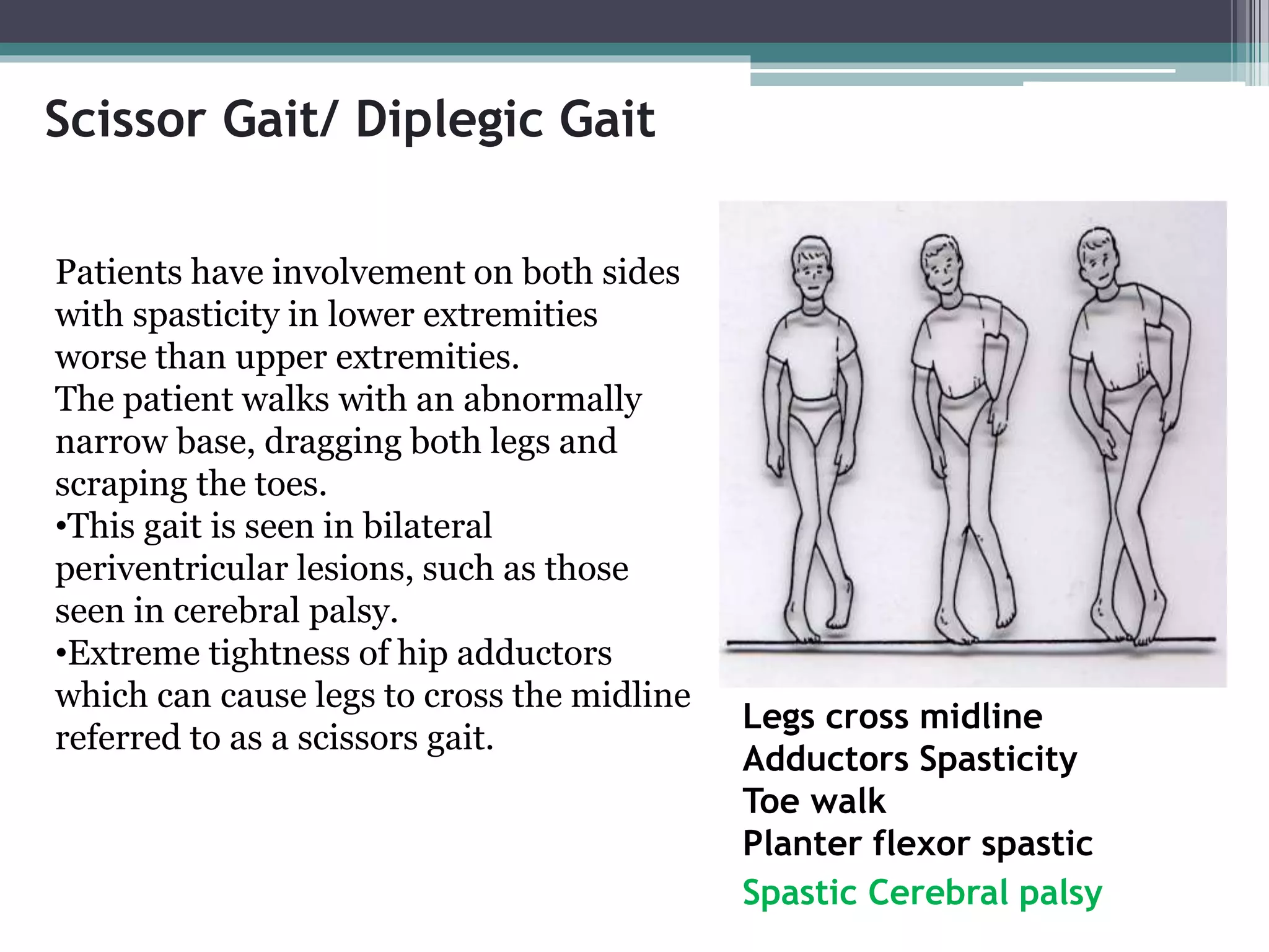 Gait abnormalities presentation | PPTX