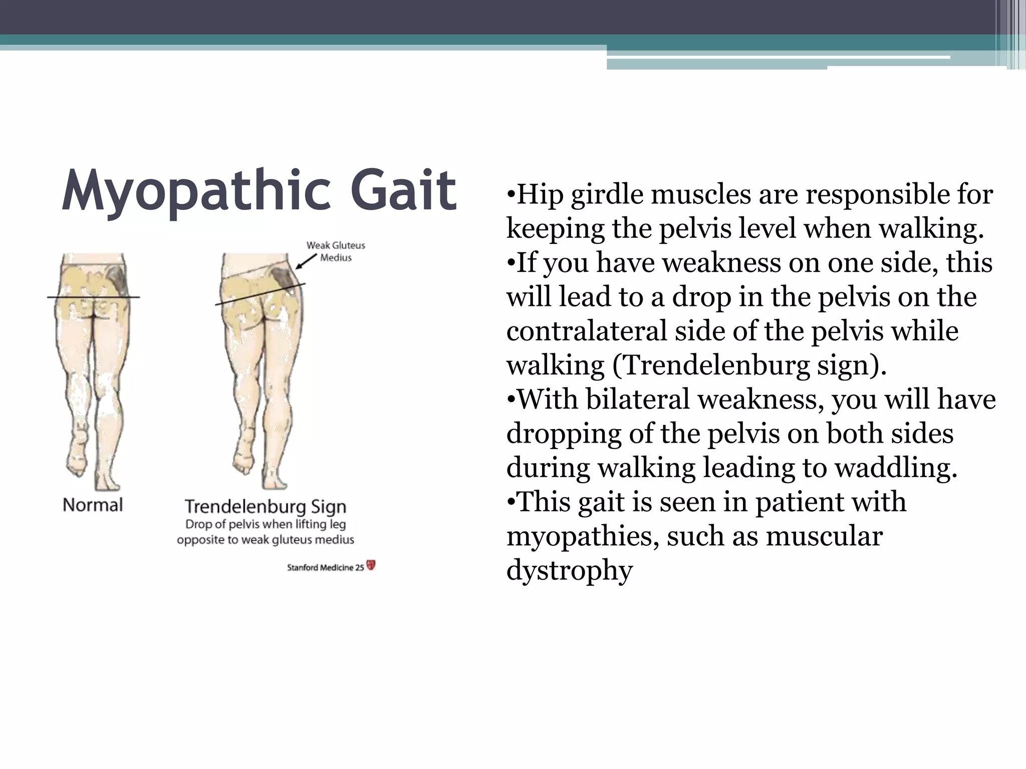 Gait abnormalities presentation | PPTX