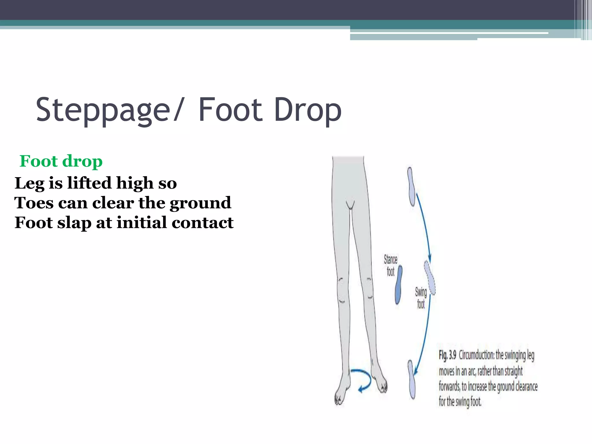 Gait abnormalities presentation | PPTX