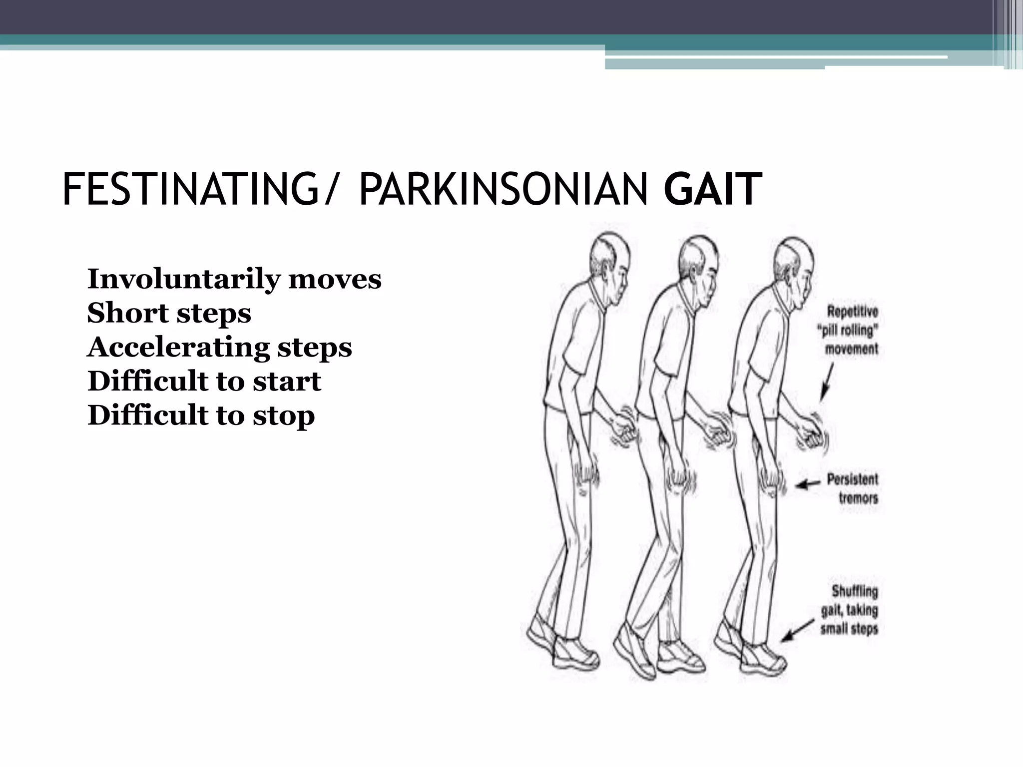 Gait abnormalities presentation | PPTX